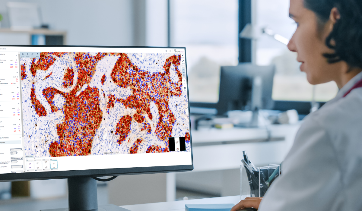 Aiforia and Techcyte announce strategic collaboration to advance AI-powered digital pathology